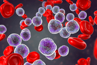 Leucemia linfoide crônica (LLC): sintomas e características genéticas ...