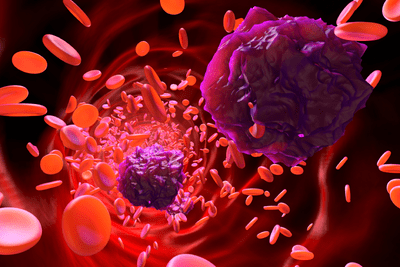 Leucemia: o que é, sintomas e tratamento | Dasa Genômica